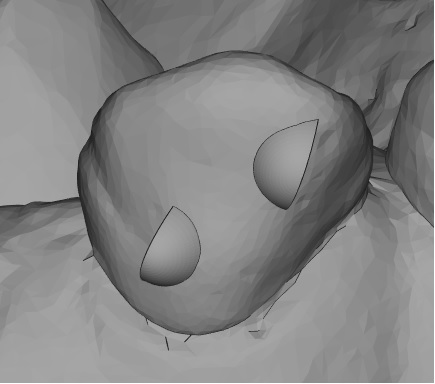 Clear Aligner Attachments Explained: Enhancing Orthodontic Treatment