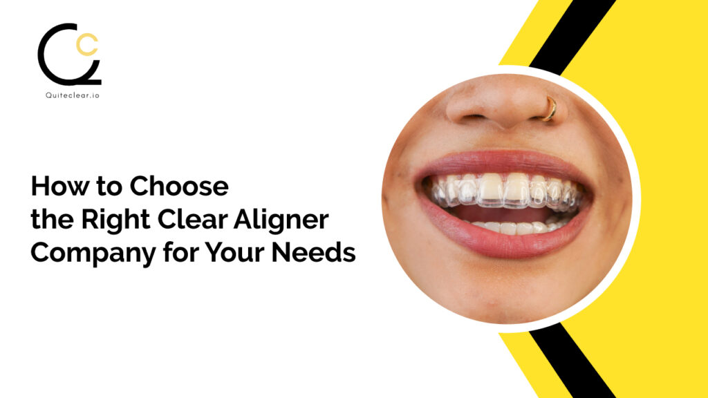 Choosing the Right Clear Aligner Company | Key Factors